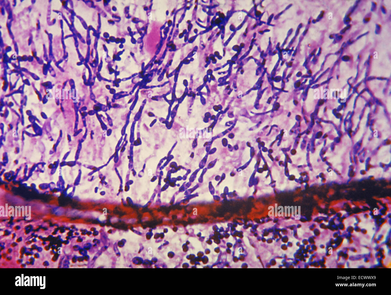 Candida albicans hi-res stock photography and images - Alamy