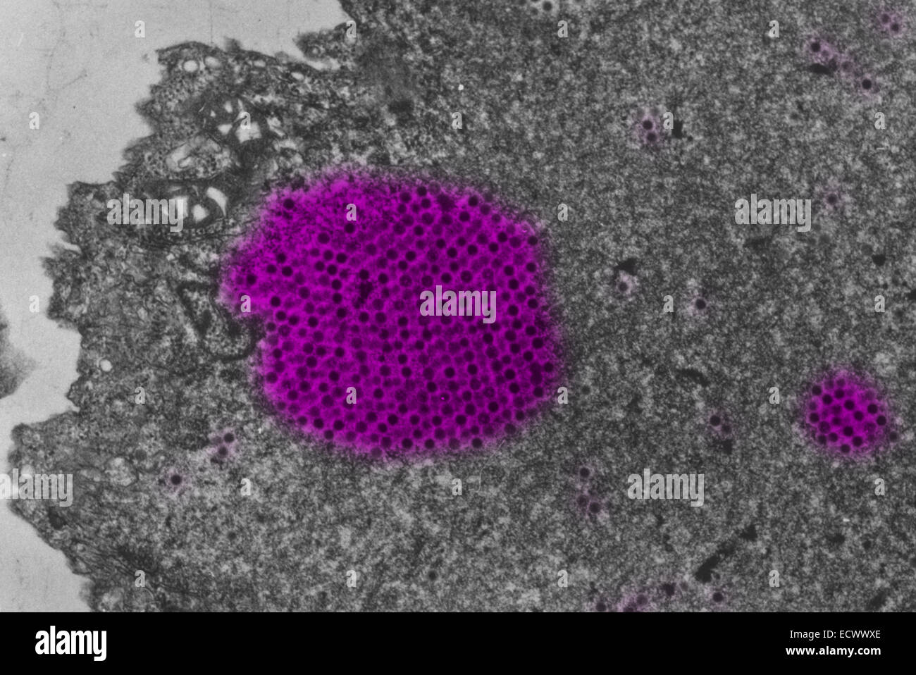 Canine adenovirus electron microscope image Stock Photo - Alamy