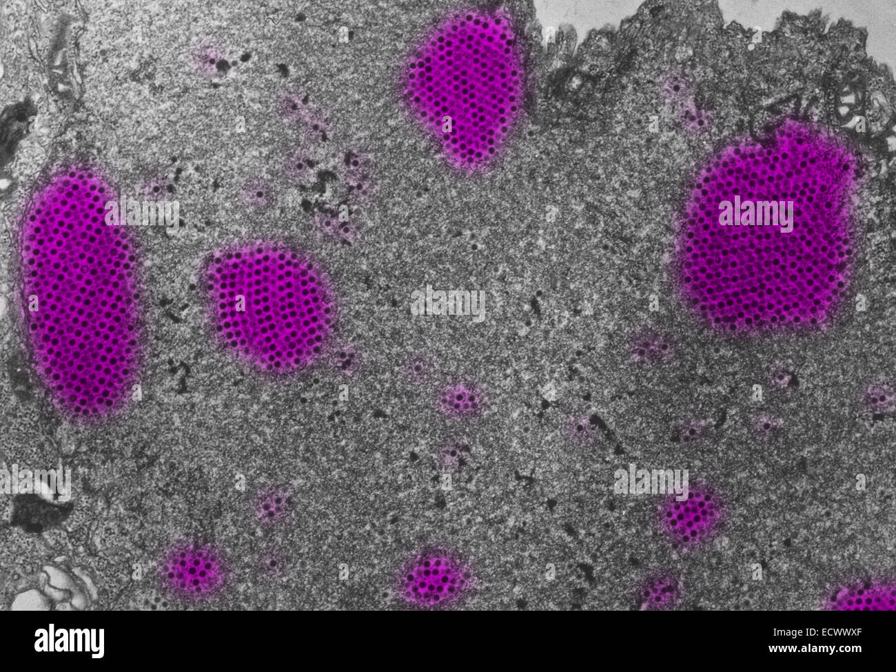Adenovirus Stock Photos & Adenovirus Stock Images - Alamy