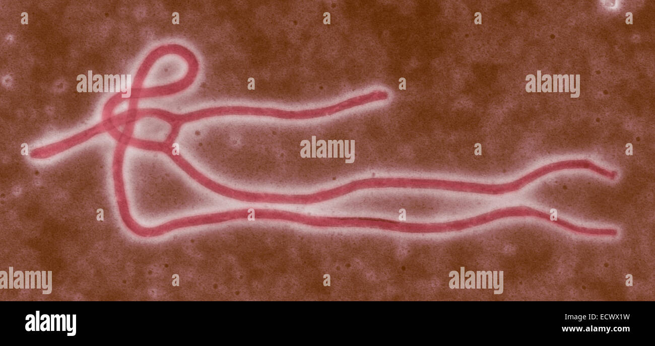 Transmission electron micrograph of an Ebola virus virion Stock Photo ...