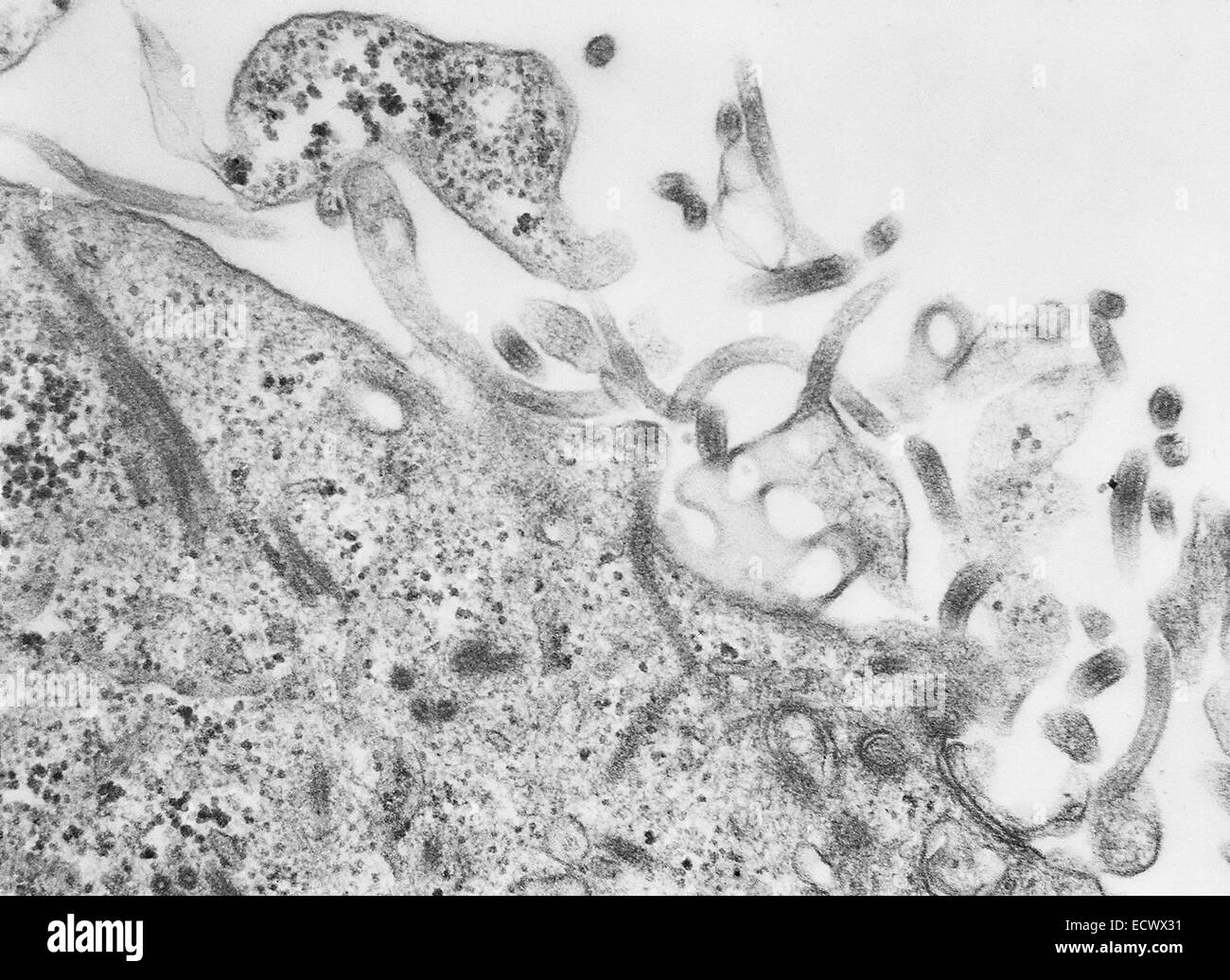 Transmission electron micrograph of Ebola virus virions Stock Photo - Alamy