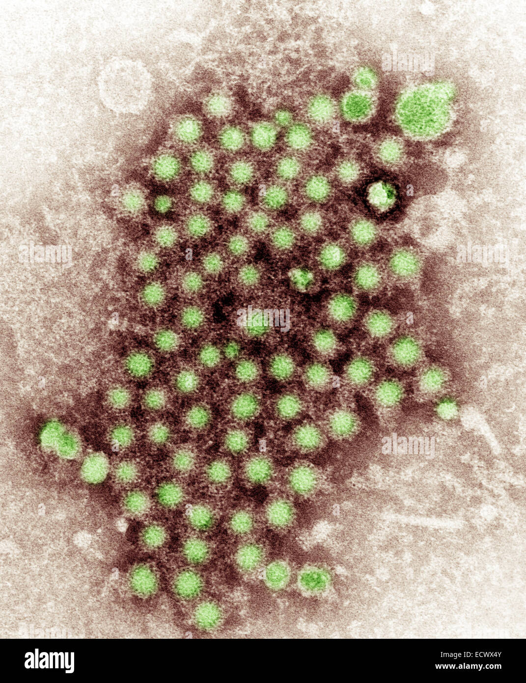Electron micrograph showing hepatitis virions Stock Photo - Alamy