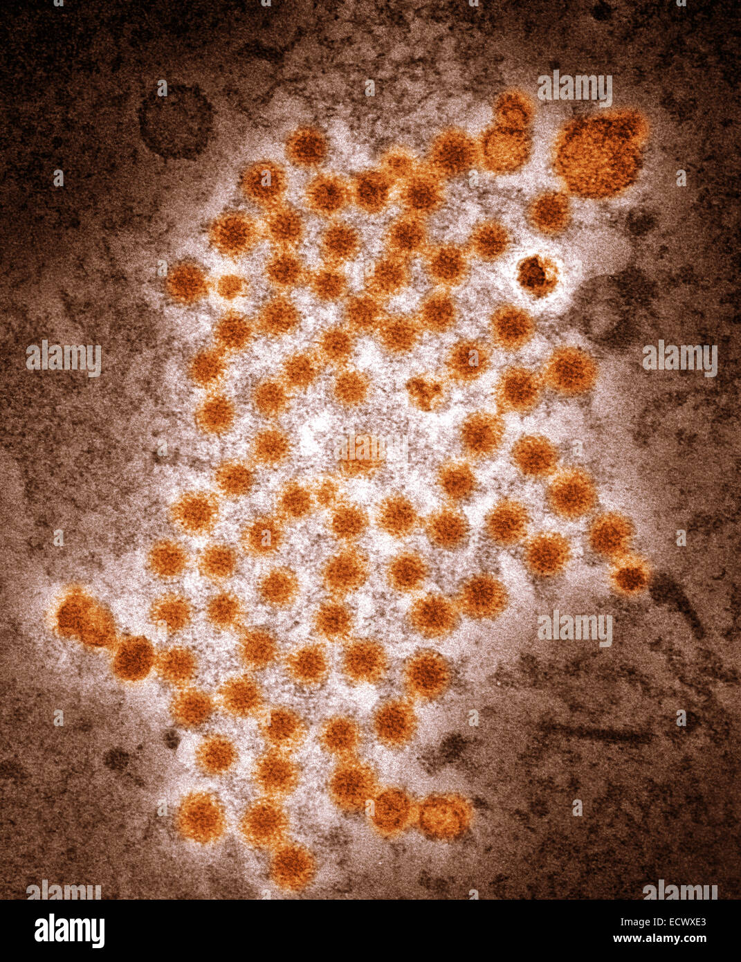 Electron micrograph showing hepatitis virions Stock Photo - Alamy
