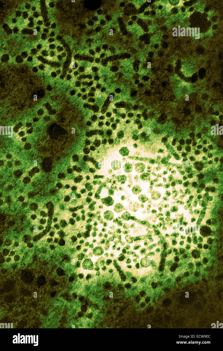 Transmission electron micrograph of hepatitis B virus Stock Photo - Alamy