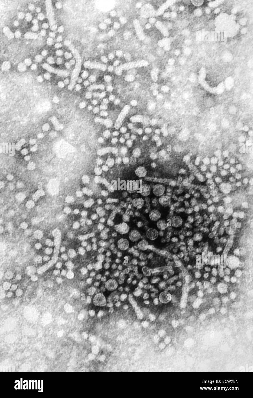 Transmission electron micrograph of hepatitis B virus Stock Photo - Alamy
