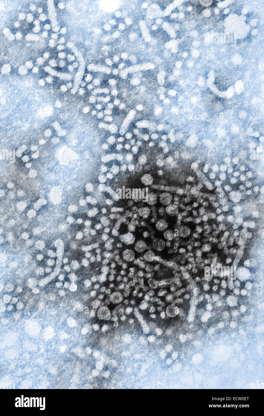 Transmission electron micrograph of hepatitis B virus Stock Photo - Alamy