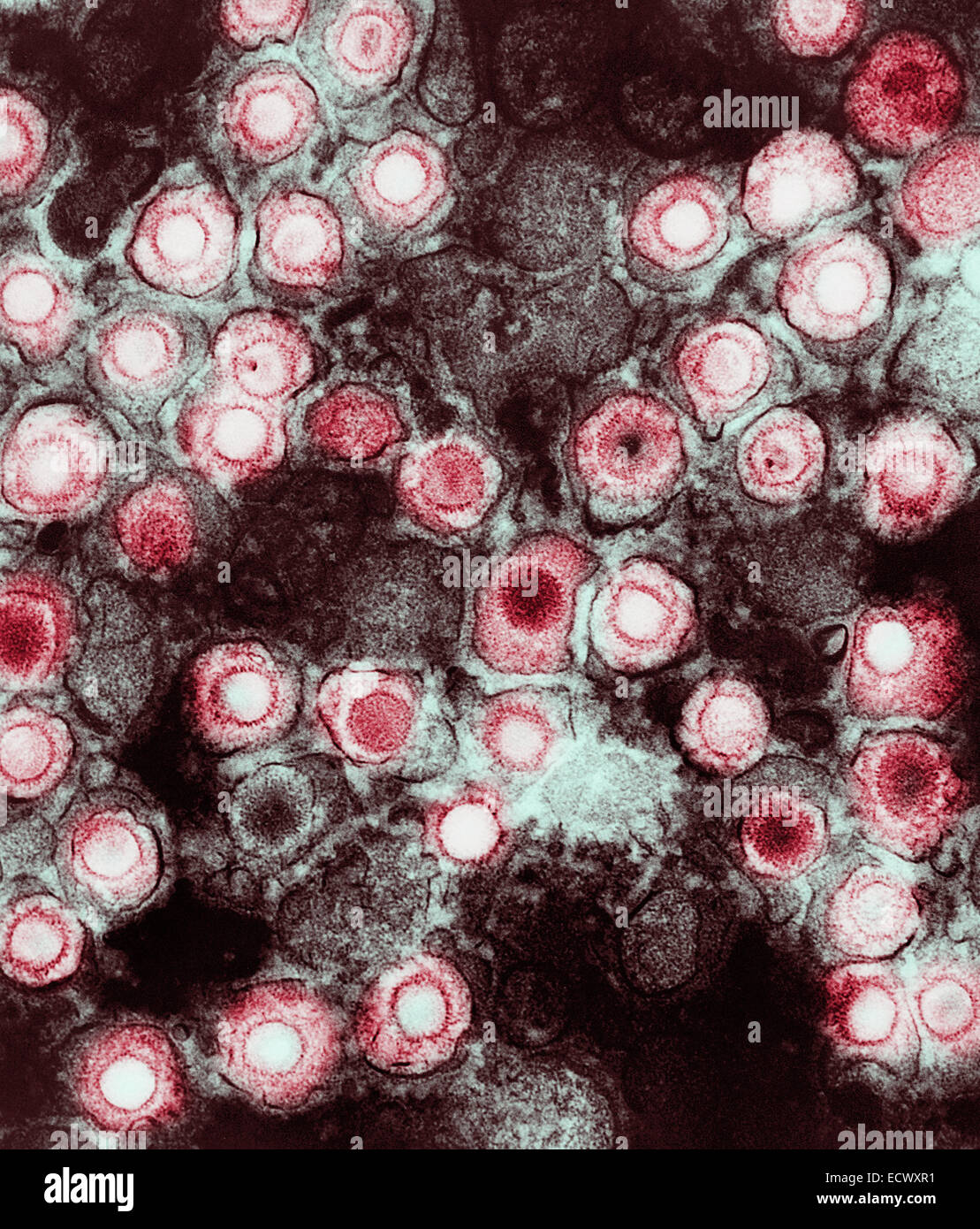 Transmission electron micrograph of herpes simplex virions Stock Photo ...