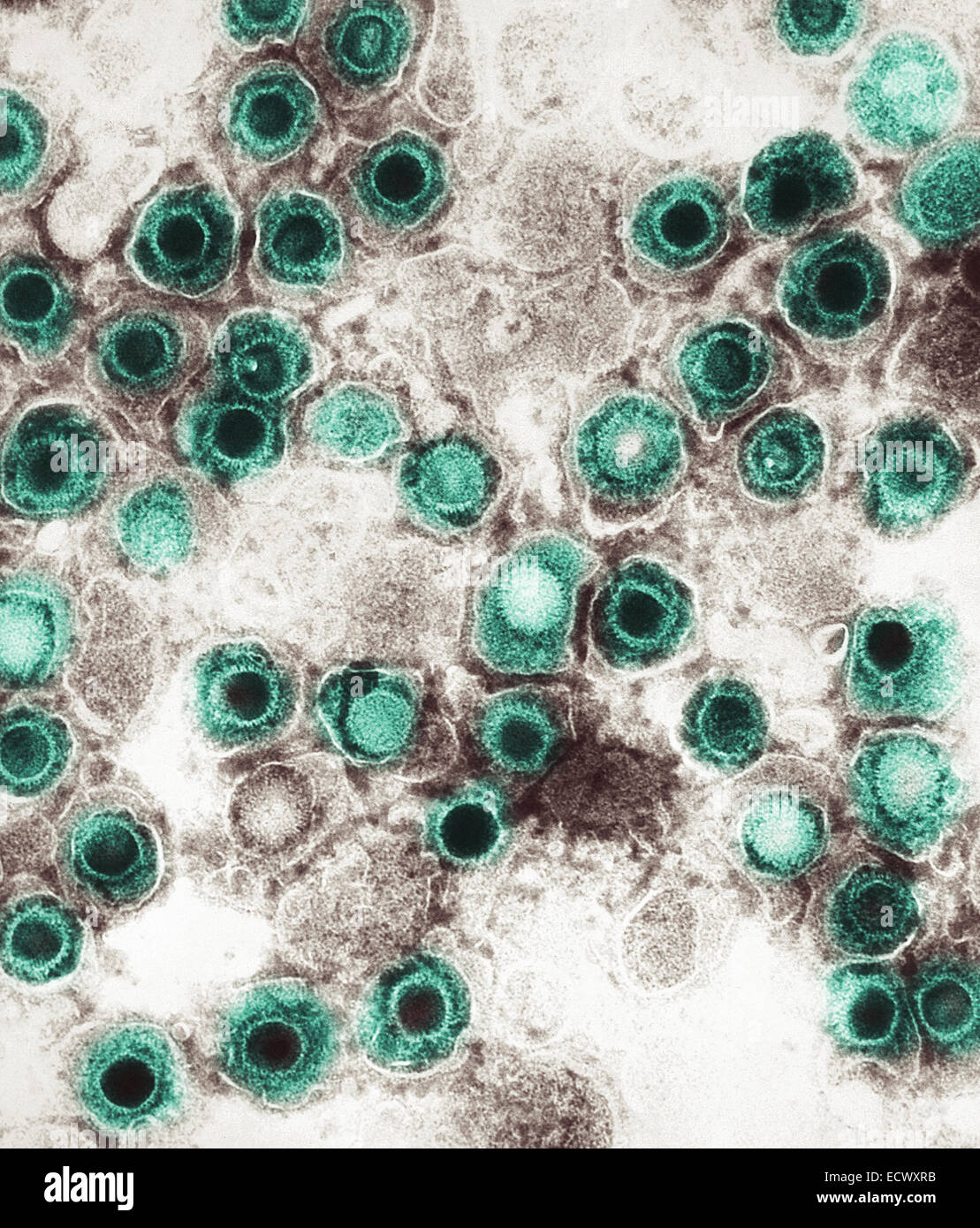 Transmission electron micrograph of herpes simplex virions Stock Photo ...