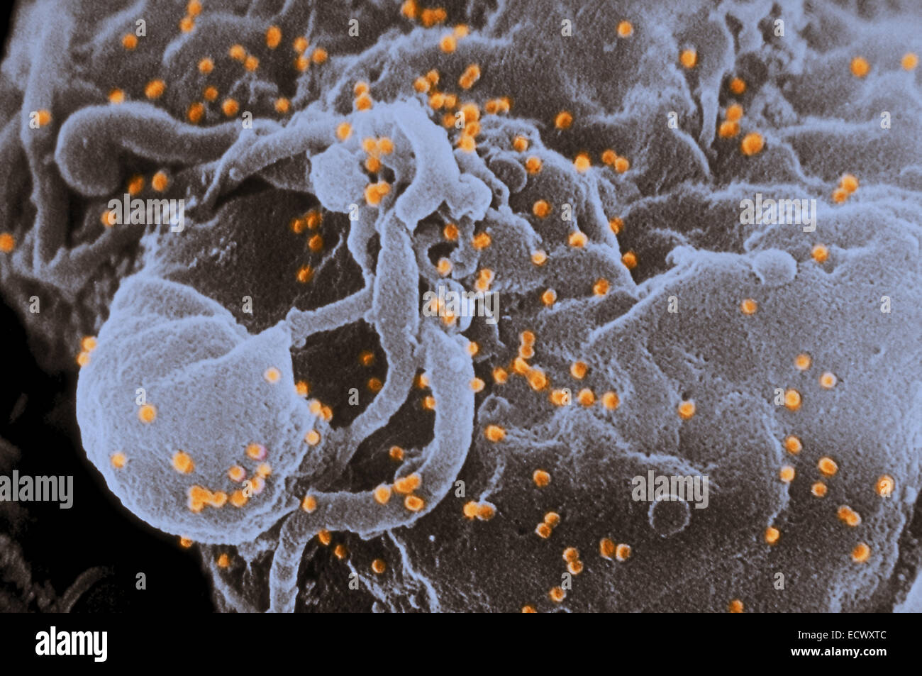 Scanning electron micrograph of HIV-1 Stock Photo - Alamy Scanning electron micrograph of HIV-1 Stock Photo - Alamy