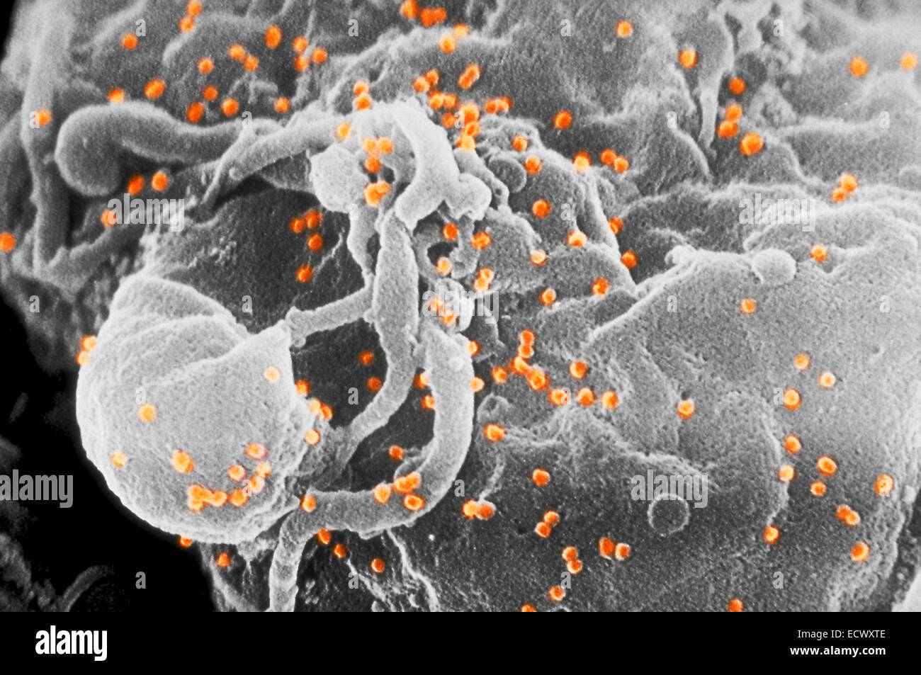 Scanning electron micrograph of HIV-1 Stock Photo - Alamy