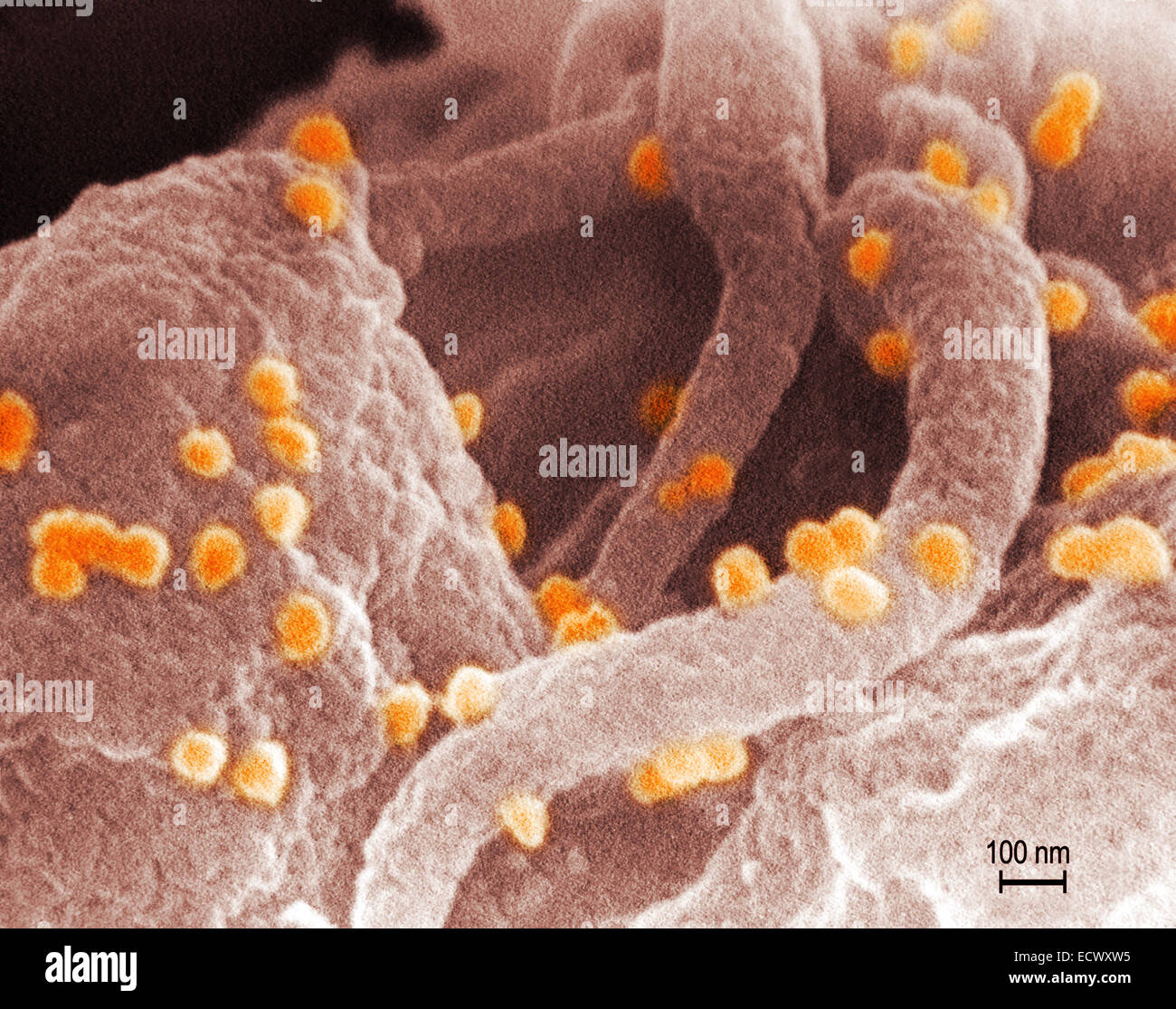 Scanning electron micrograph of HIV Stock Photo - Alamy