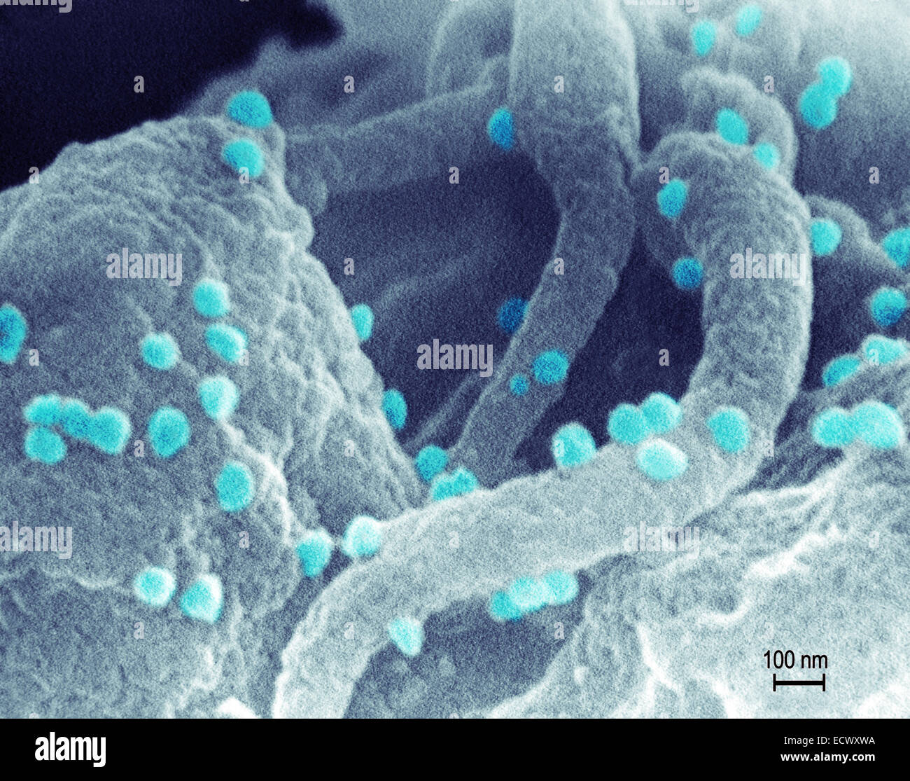 Scanning electron micrograph of HIV Stock Photo - Alamy
