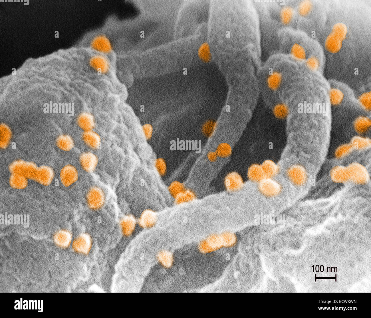 Scanning electron micrograph of HIV Stock Photo - Alamy