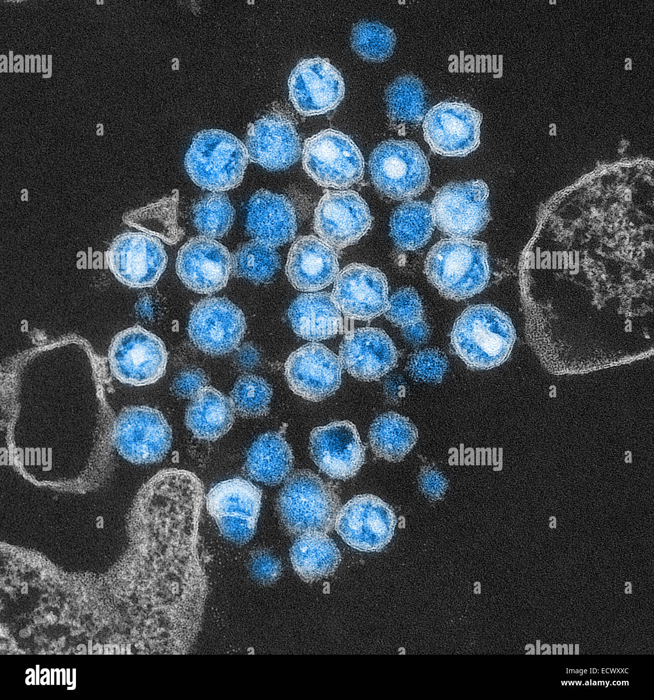 Electron micrograph of Human Immunodeficiency Virus, HIV Stock Photo ...