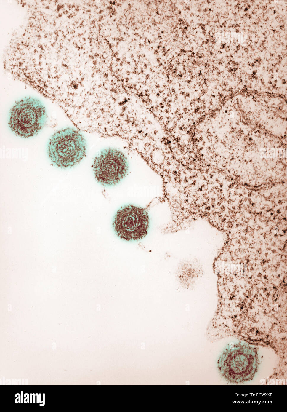 Human herpes virus 6 hi-res stock photography and images - Alamy