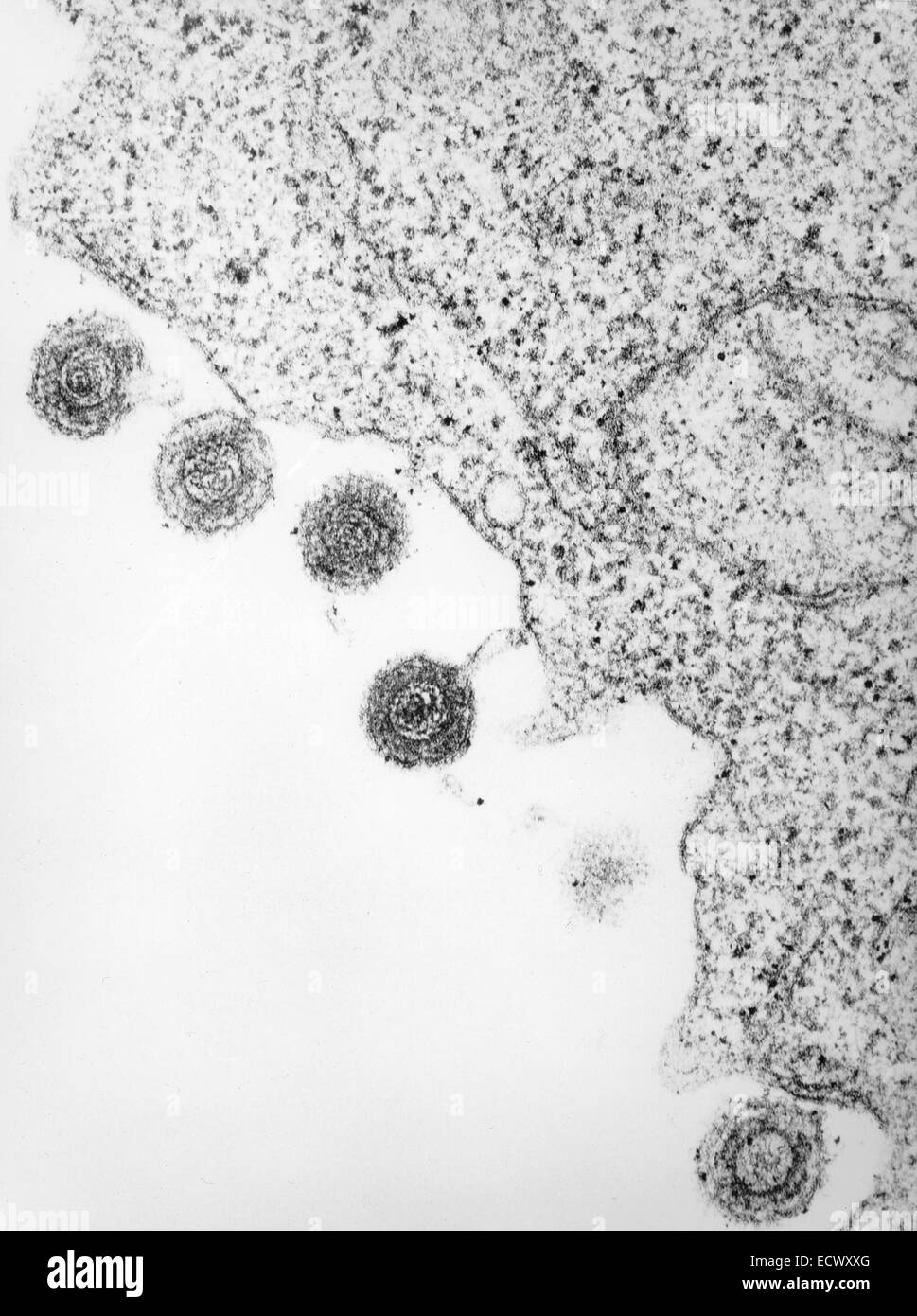 Human herpes virus 6 hi-res stock photography and images - Alamy