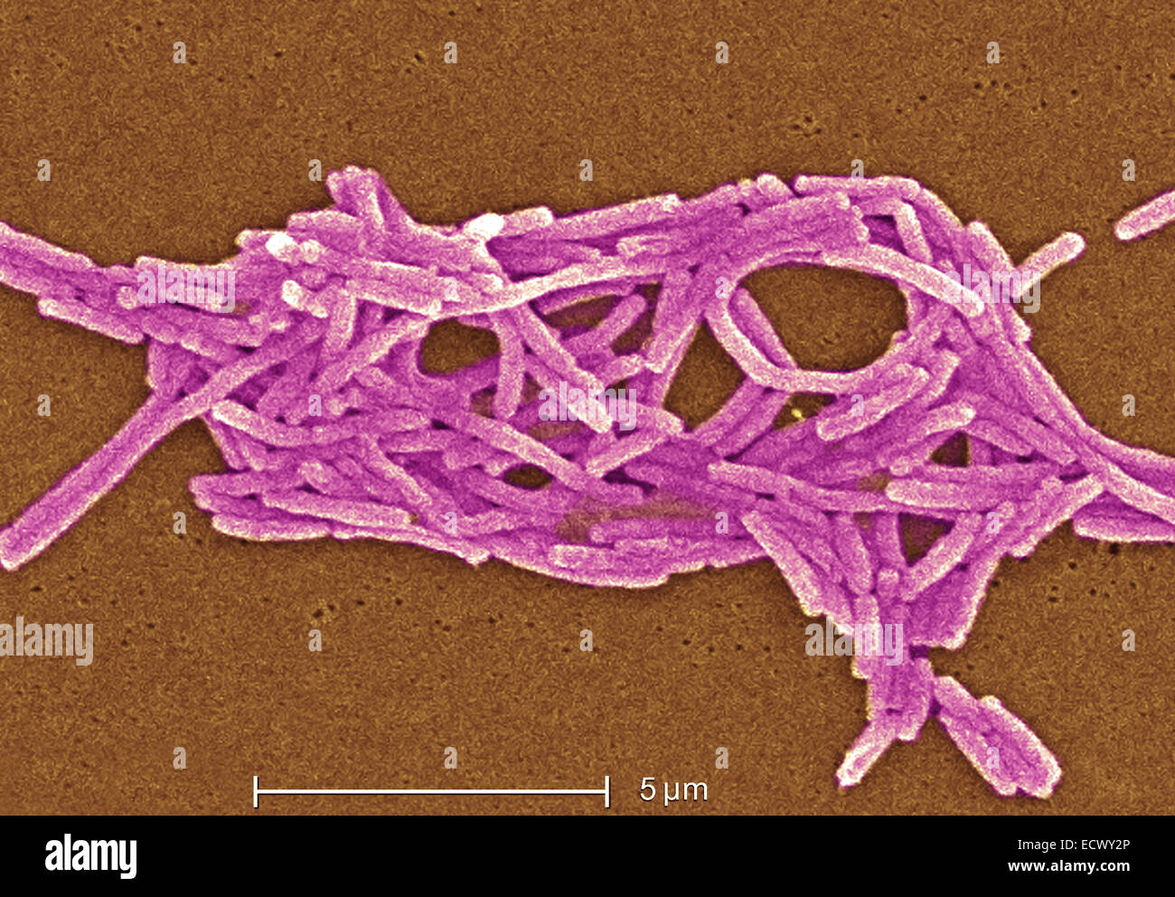 Scanning electron micrograph of Legionella bacteria Stock Photo - Alamy