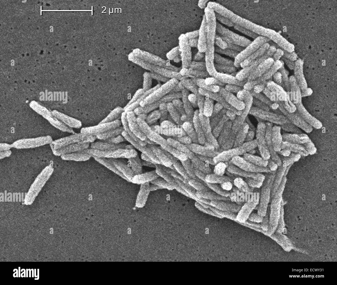 Legionella hi-res stock photography and images - Alamy