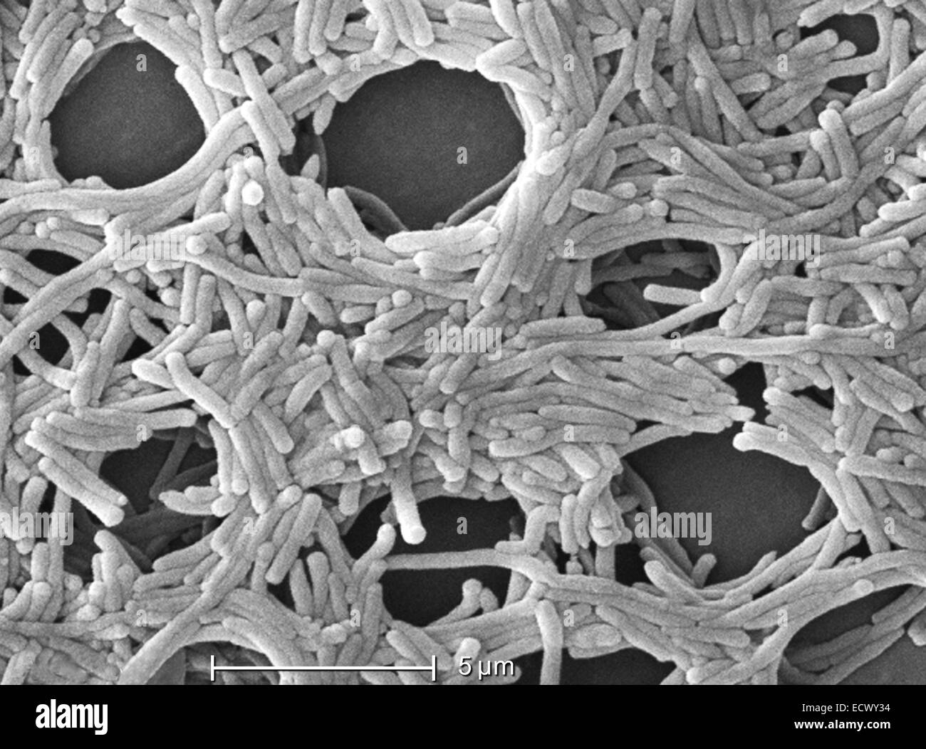 Scanning electron micrograph Black and White Stock Photos & Images - Alamy