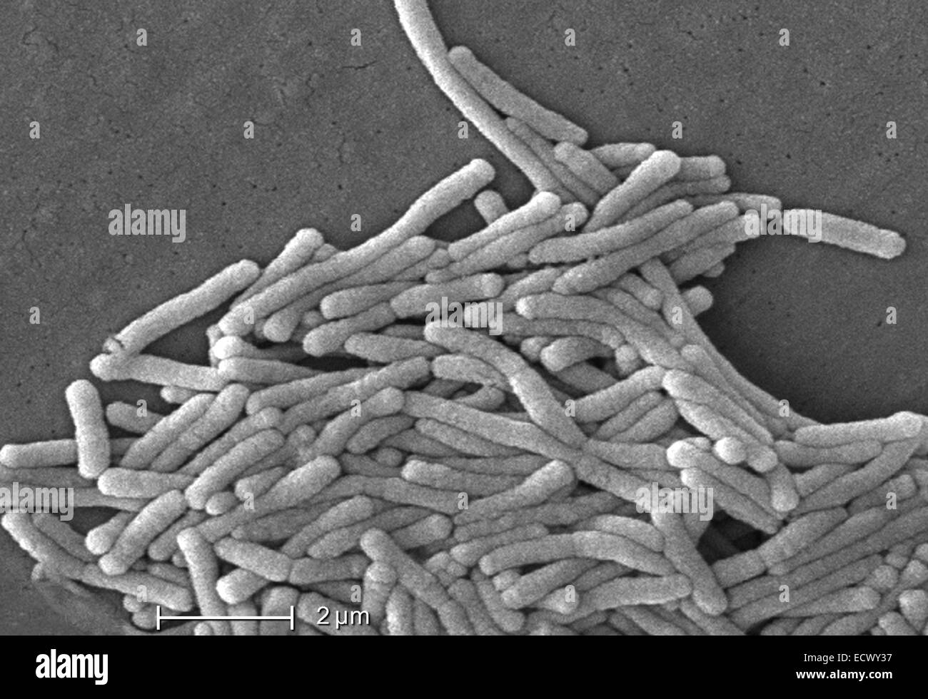 Scanning electron micrograph Black and White Stock Photos & Images - Alamy