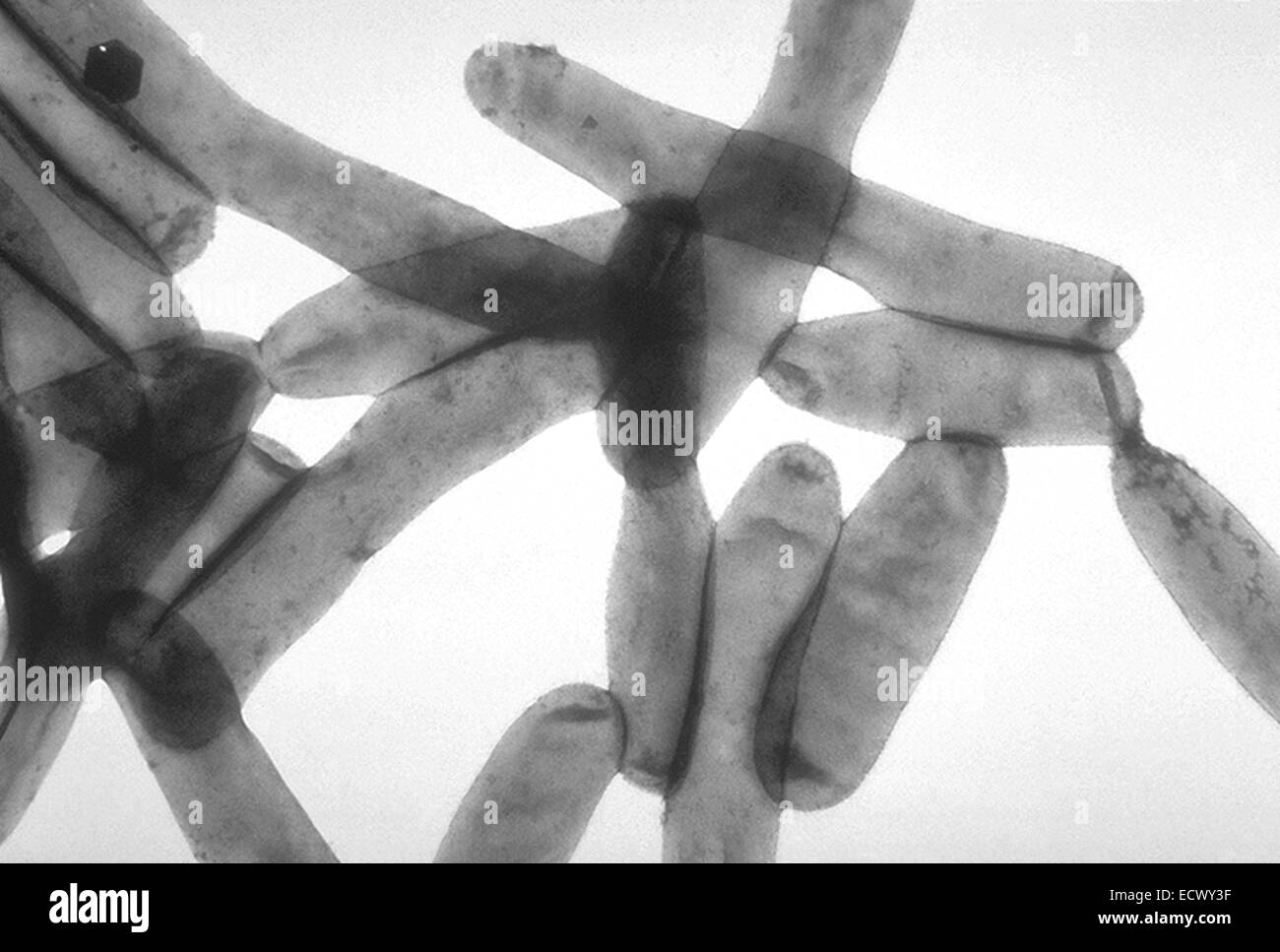 Scanning electron micrograph of Legionella bacteria Stock Photo - Alamy