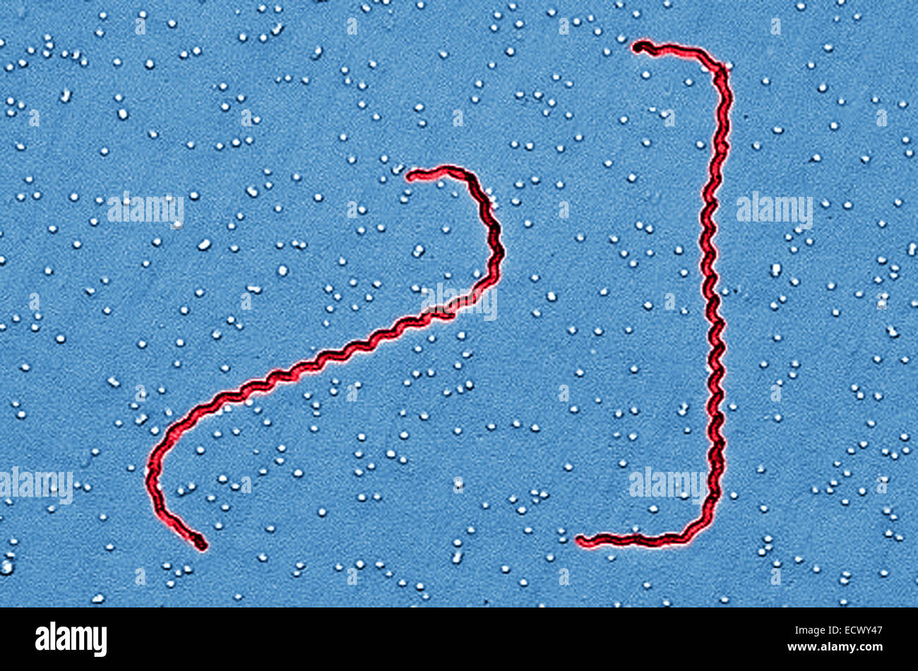 Scanning electron micrograph of Leptospira bacteria Stock Photo - Alamy