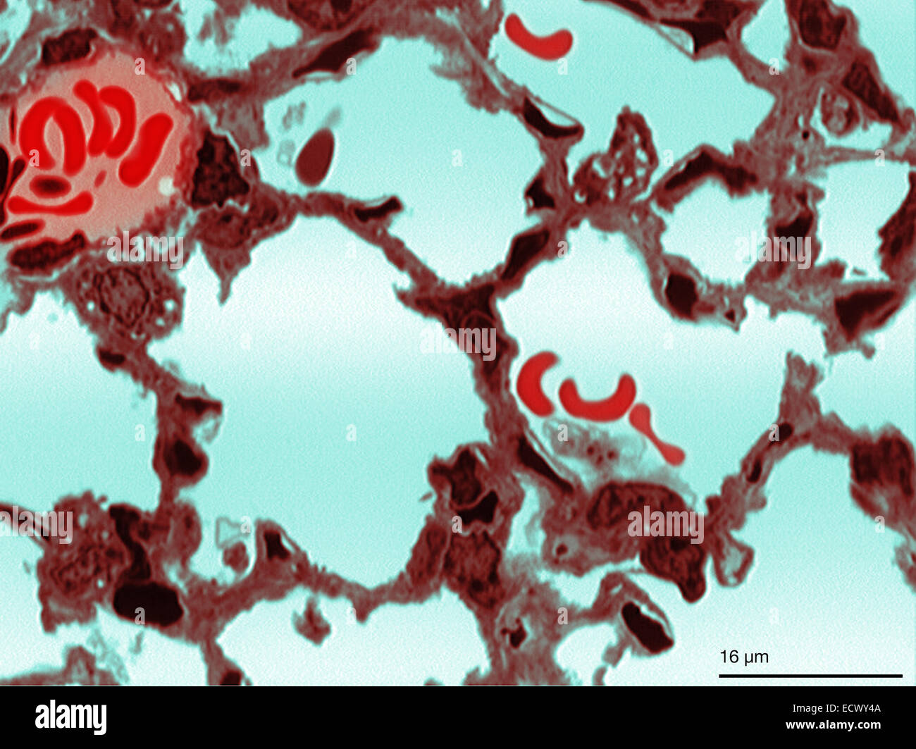 Light microscope image of mouse lung cells Stock Photo - Alamy