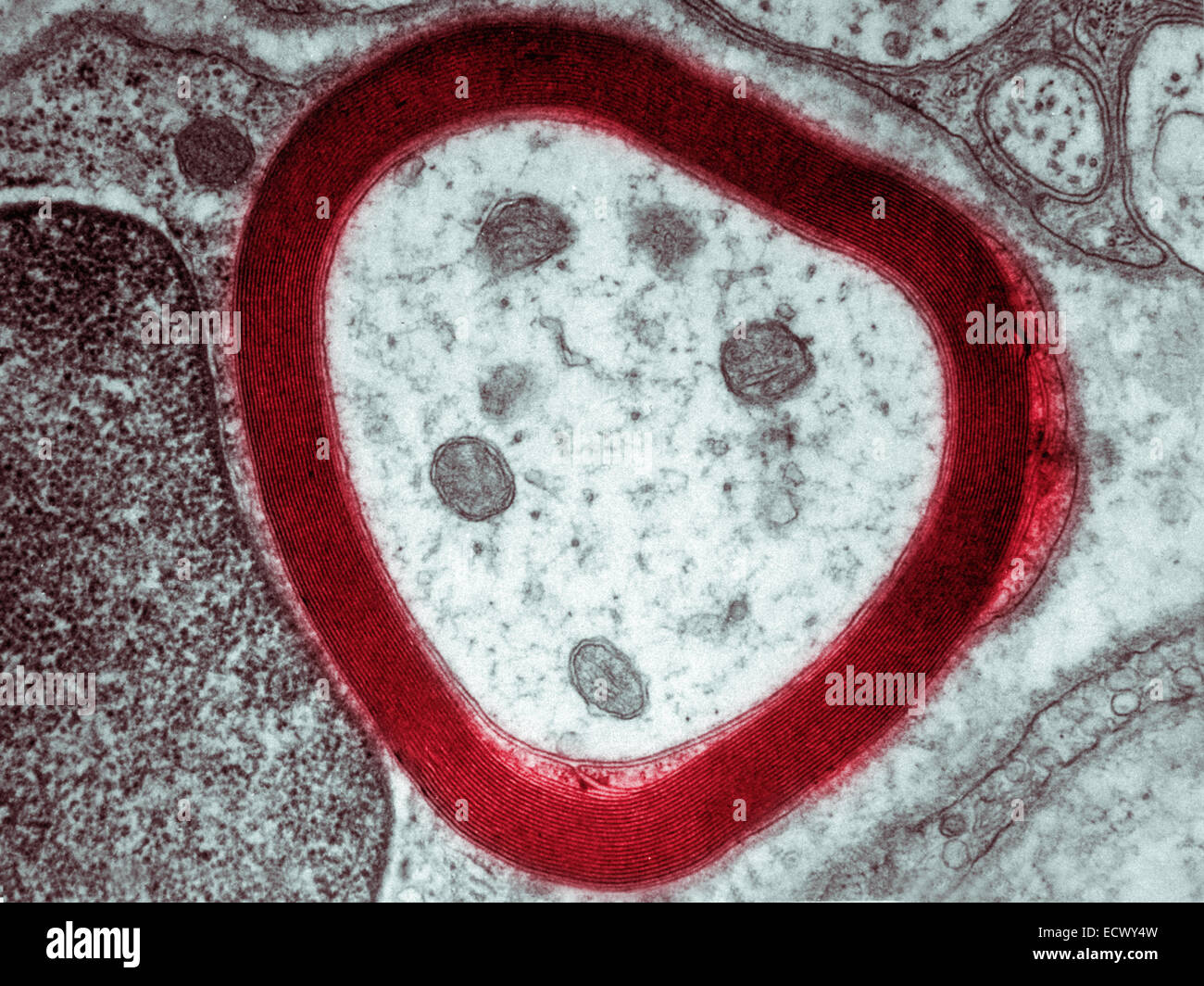 Myelin sheath hi-res stock photography and images - Alamy