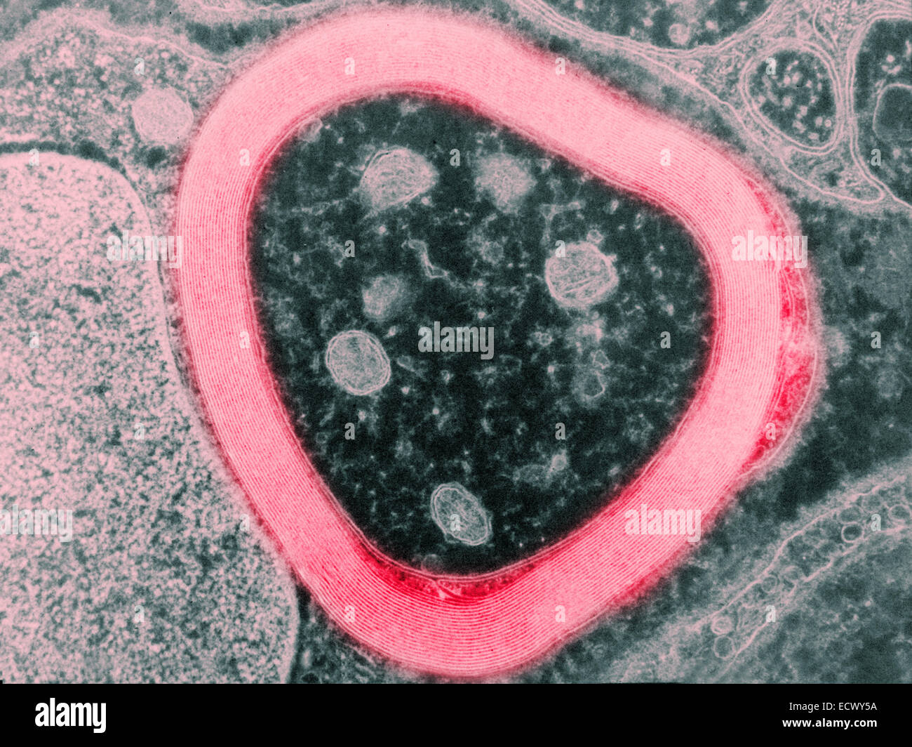 Myelin sheath hi-res stock photography and images - Alamy