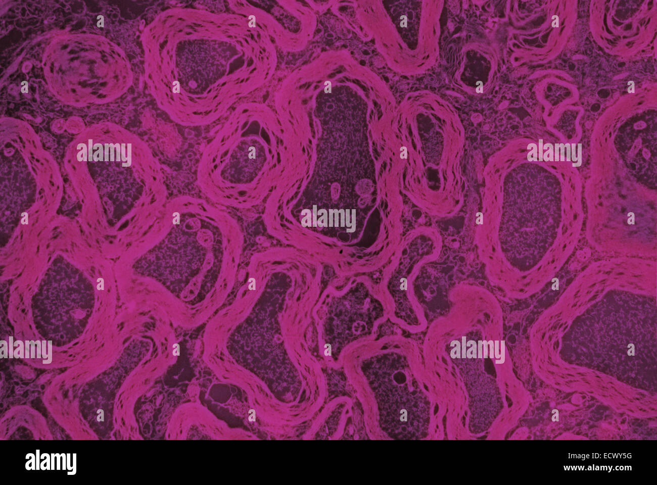 Nerve cell micrograph hi-res stock photography and images - Alamy
