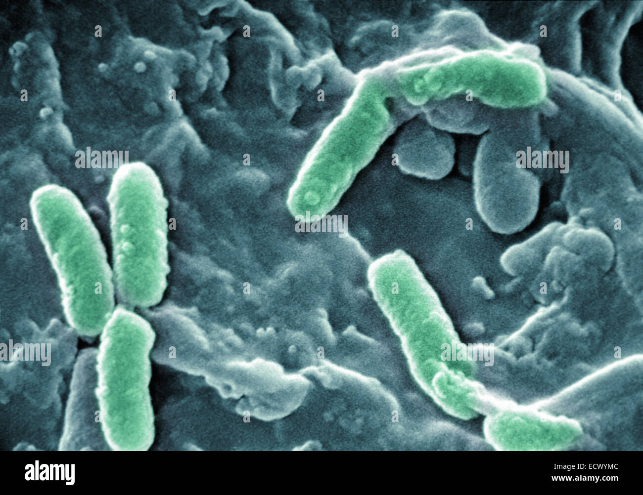 Pseudomonas aeruginosa hi-res stock photography and images - Alamy