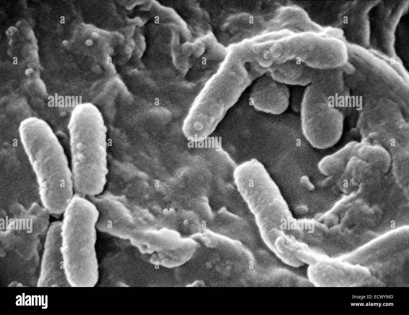 Pseudomonas aeruginosa hi-res stock photography and images - Alamy