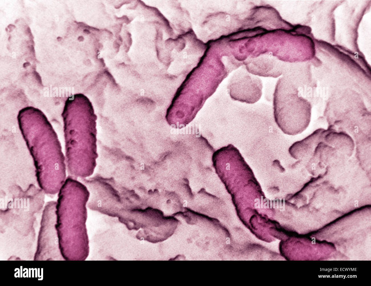 Pseudomonas aeruginosa hi-res stock photography and images - Alamy