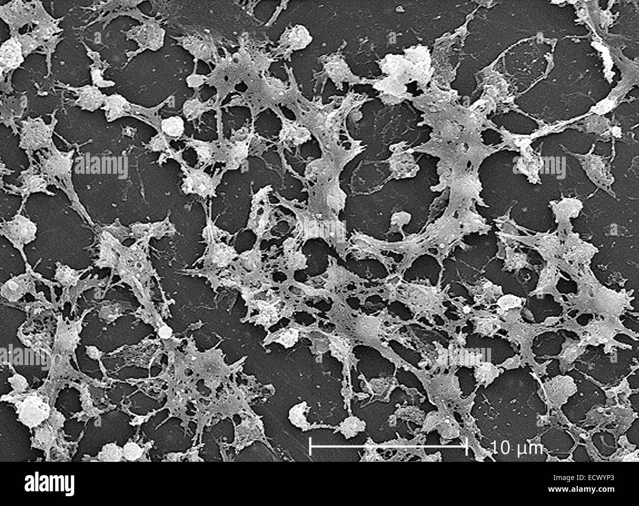 Electron micrograph showing Staphylococcus aureus bacteria Stock Photo ... Electron micrograph showing Staphylococcus aureus bacteria Stock Photo ...