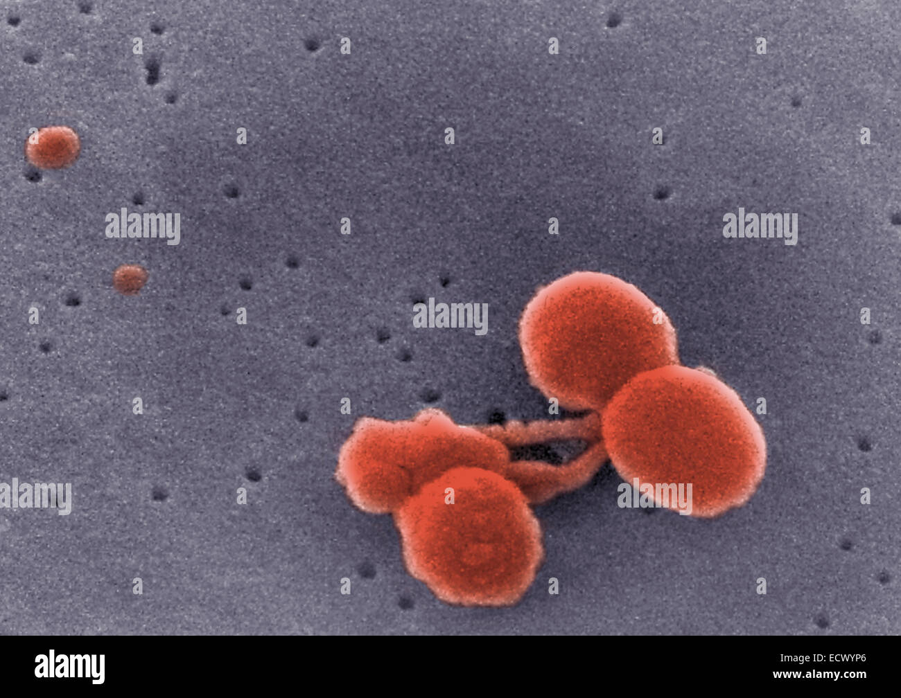 Streptococcus Pneumoniae Stock Photos & Streptococcus Pneumoniae Stock ...