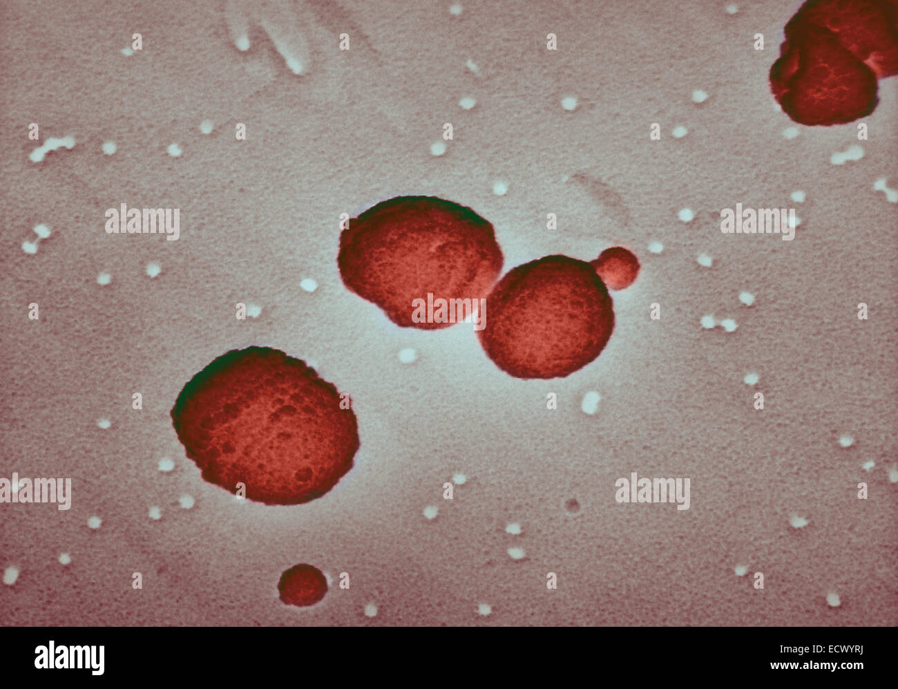 Scanning electron micrograph Streptococcus pneumoniae Stock Photo - Alamy