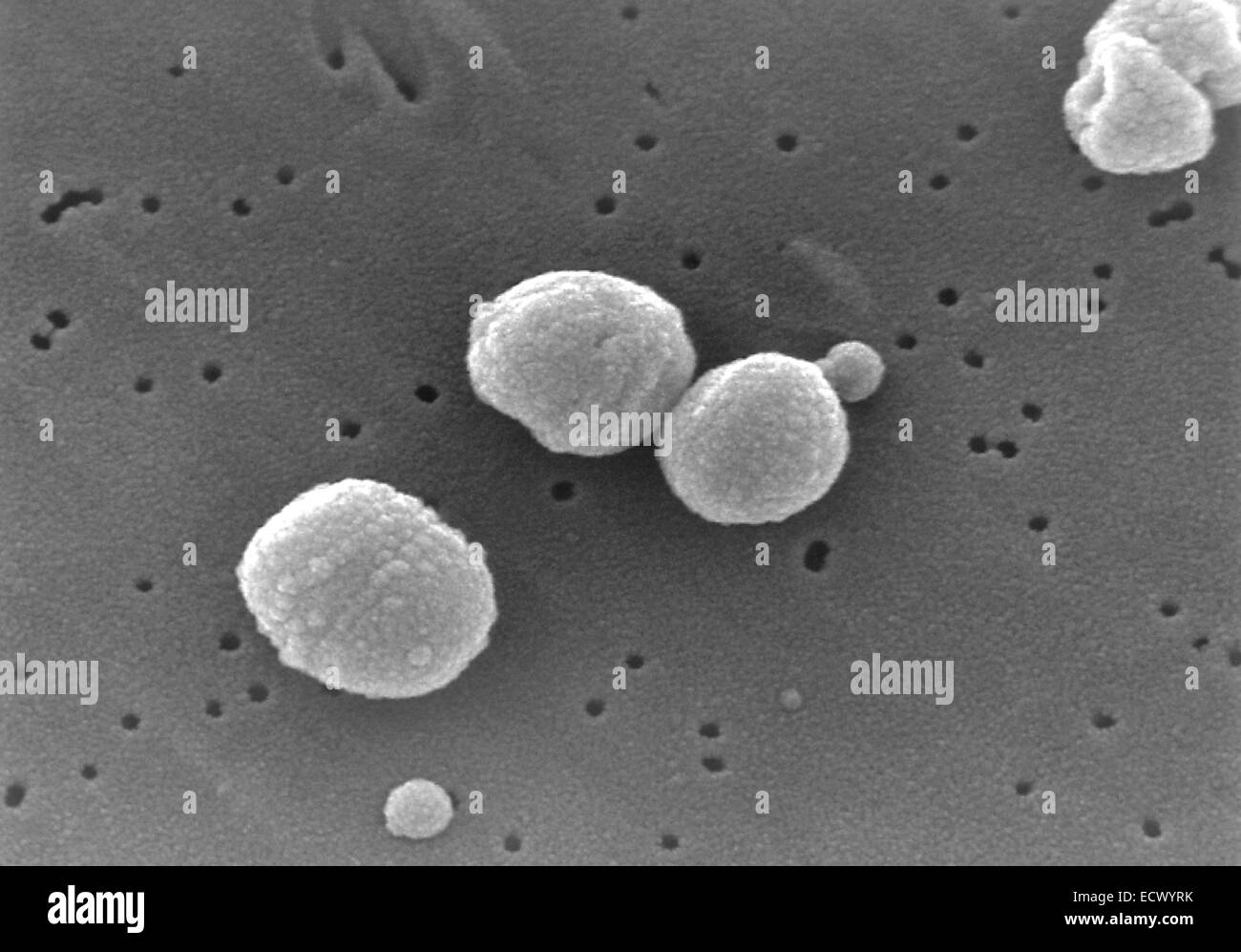 Streptococcus Pneumoniae Electron Micrograph