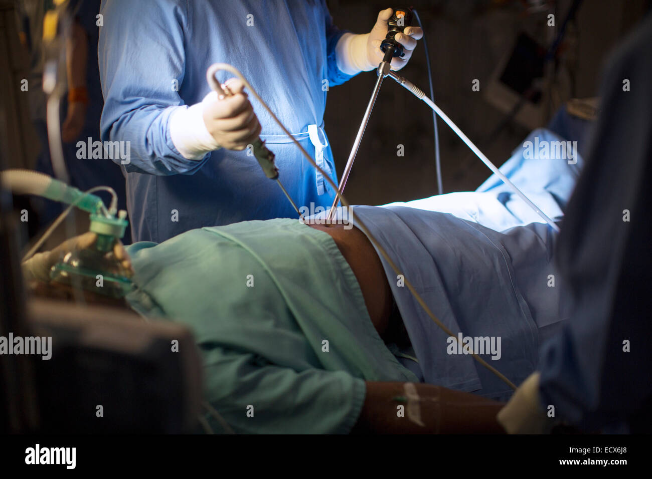 Abdominal surgery hi-res stock photography and images - Alamy