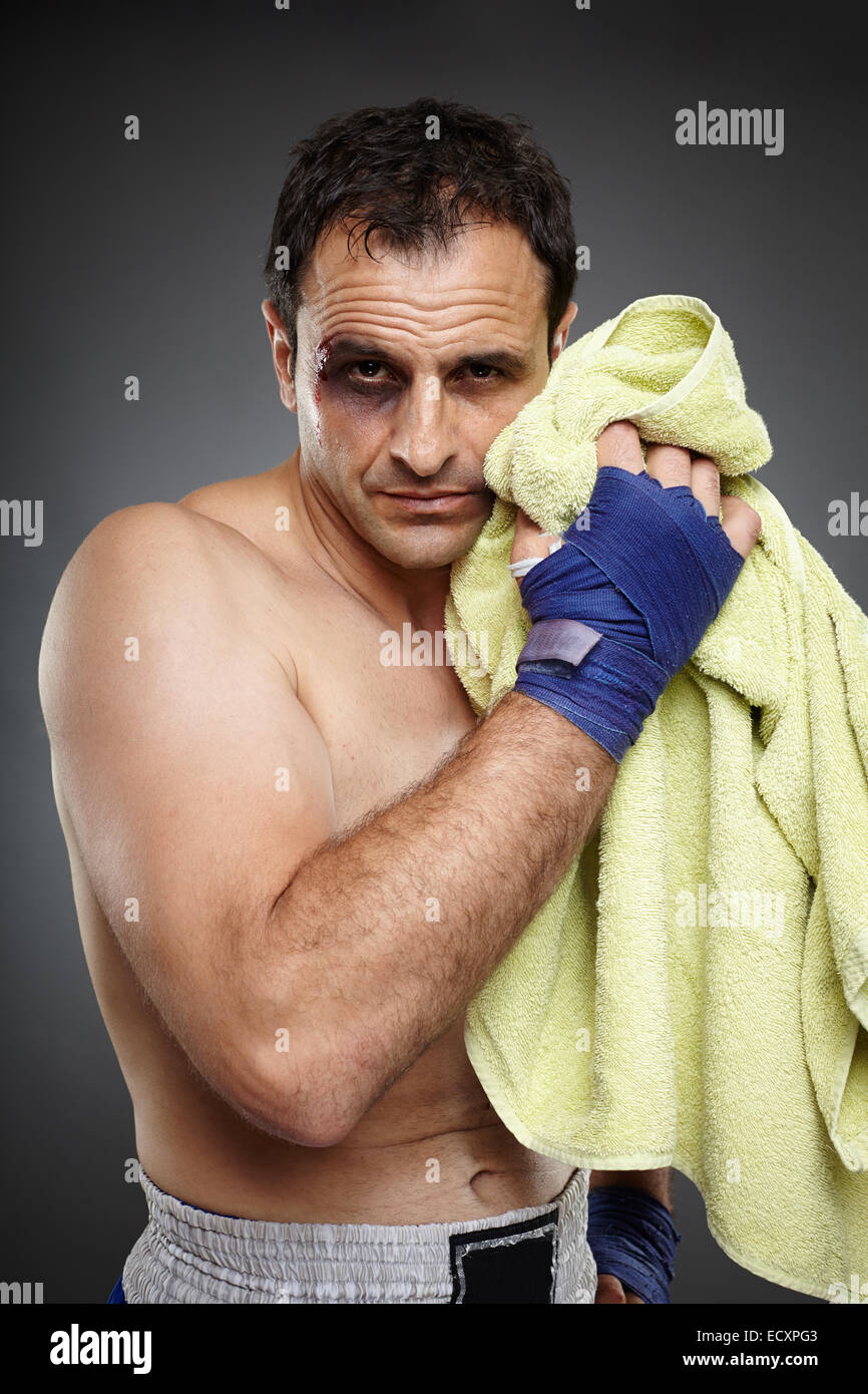 Bruises hi-res stock photography and images - Alamy