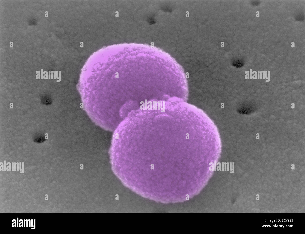 Scanning electron micrograph Streptococcus pneumoniae Stock Photo - Alamy Scanning electron micrograph Streptococcus pneumoniae Stock Photo - Alamy