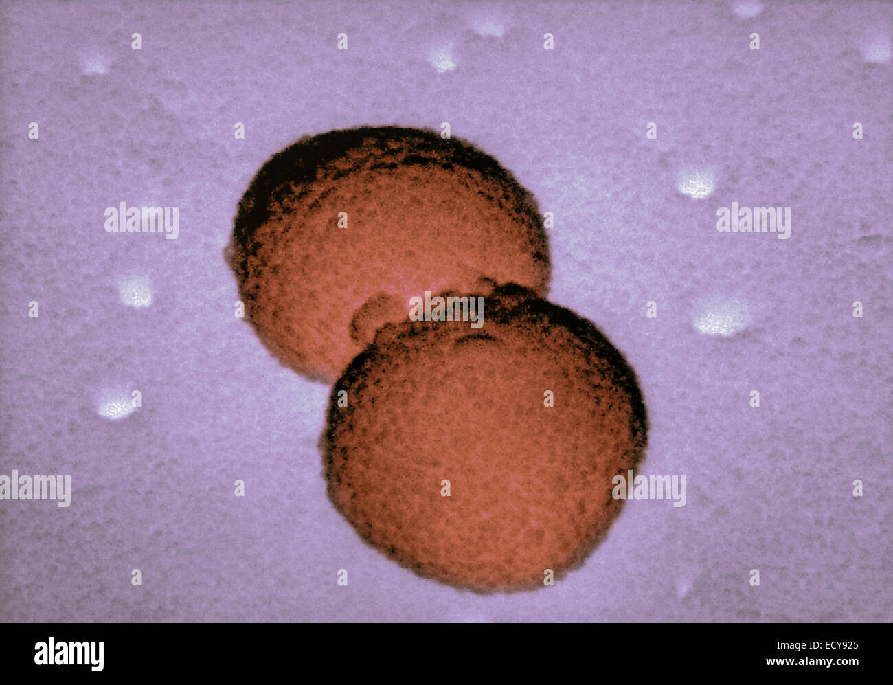 Scanning electron micrograph Streptococcus pneumoniae Stock Photo - Alamy