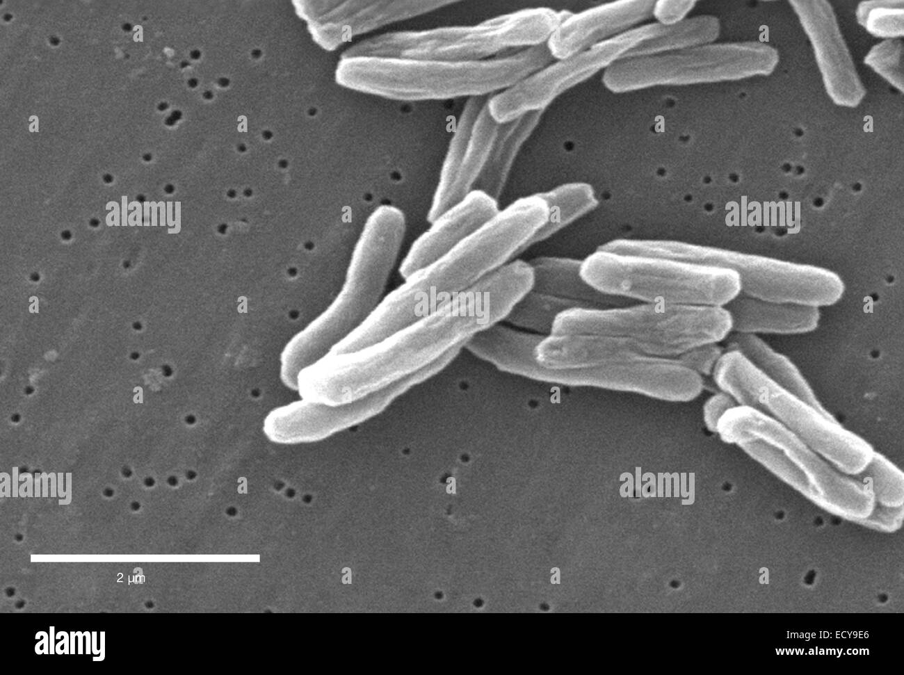 Scanning electron micrograph of tuberculosis bacteria Stock Photo - Alamy
