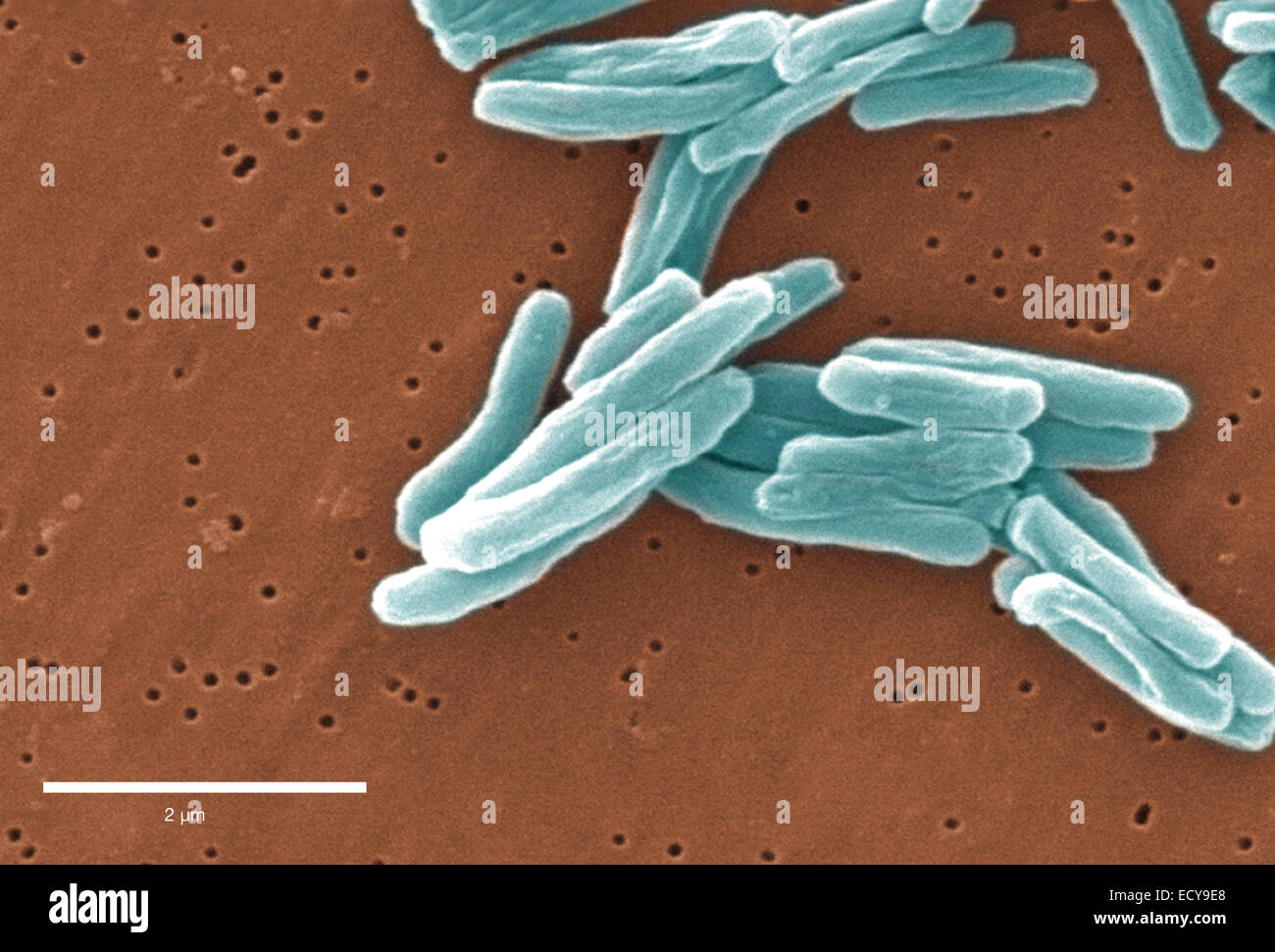 Scanning electron micrograph of tuberculosis bacteria Stock Photo - Alamy