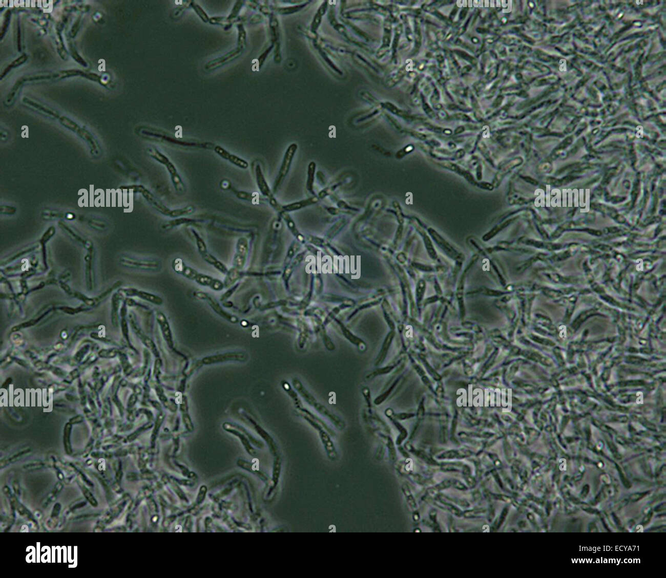 Bacillus anthracis micrograph hi-res stock photography and images - Alamy