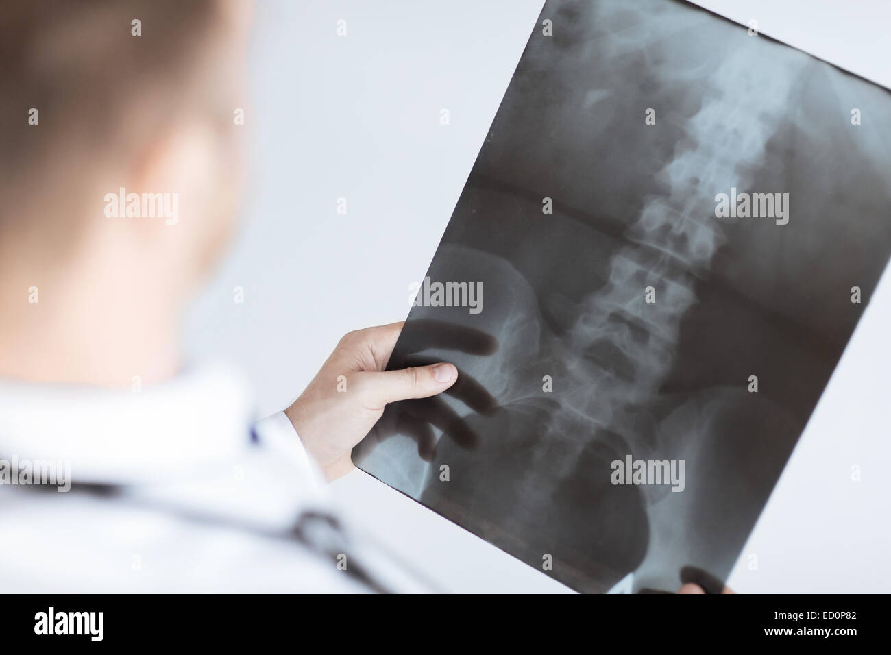 doctor holding x-ray or roentgen image Stock Photo - Alamy
