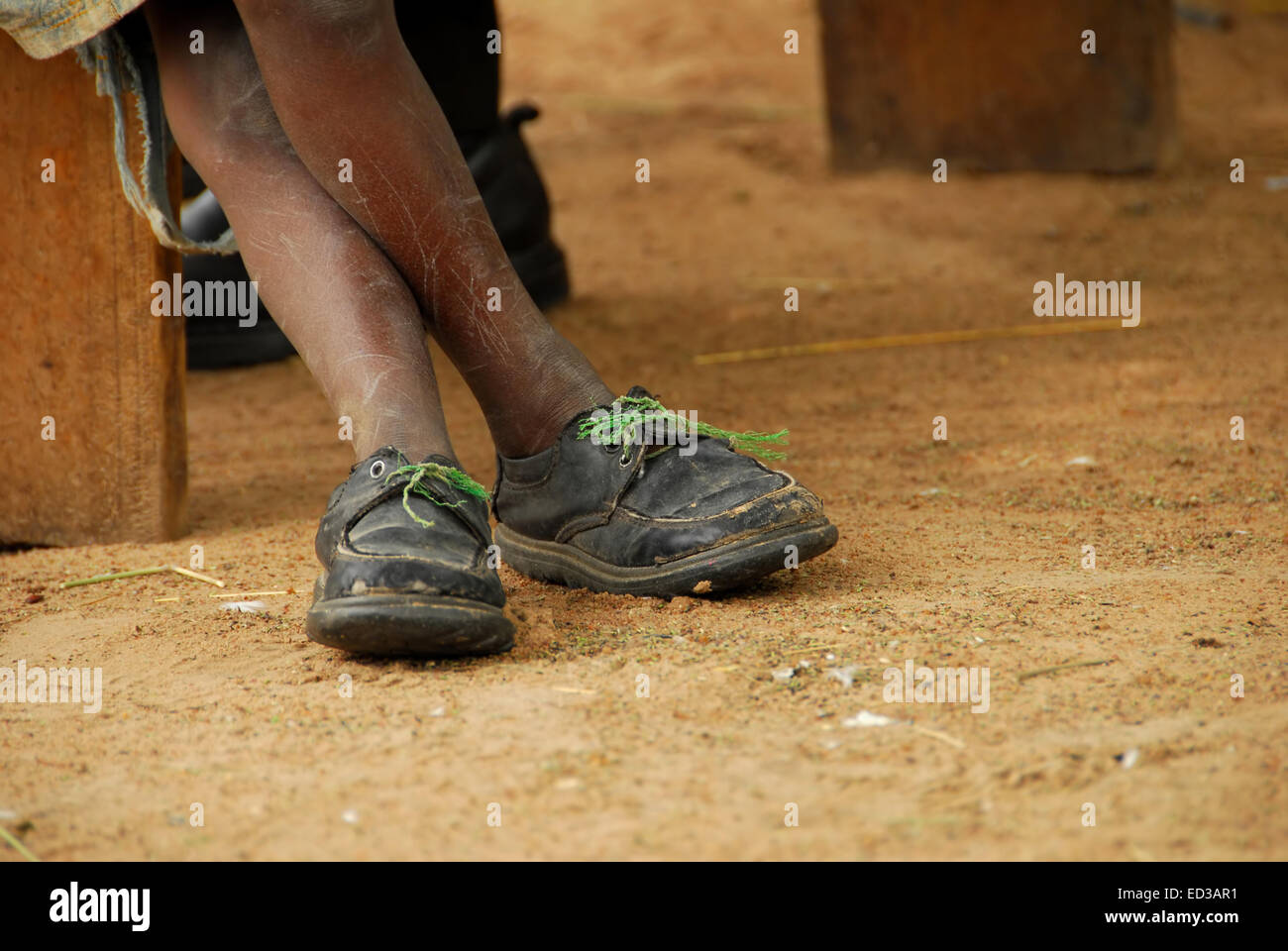 Poor feet hi-res stock photography and images - Alamy