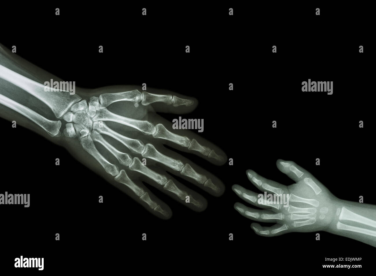 Xray Hand Anatomy