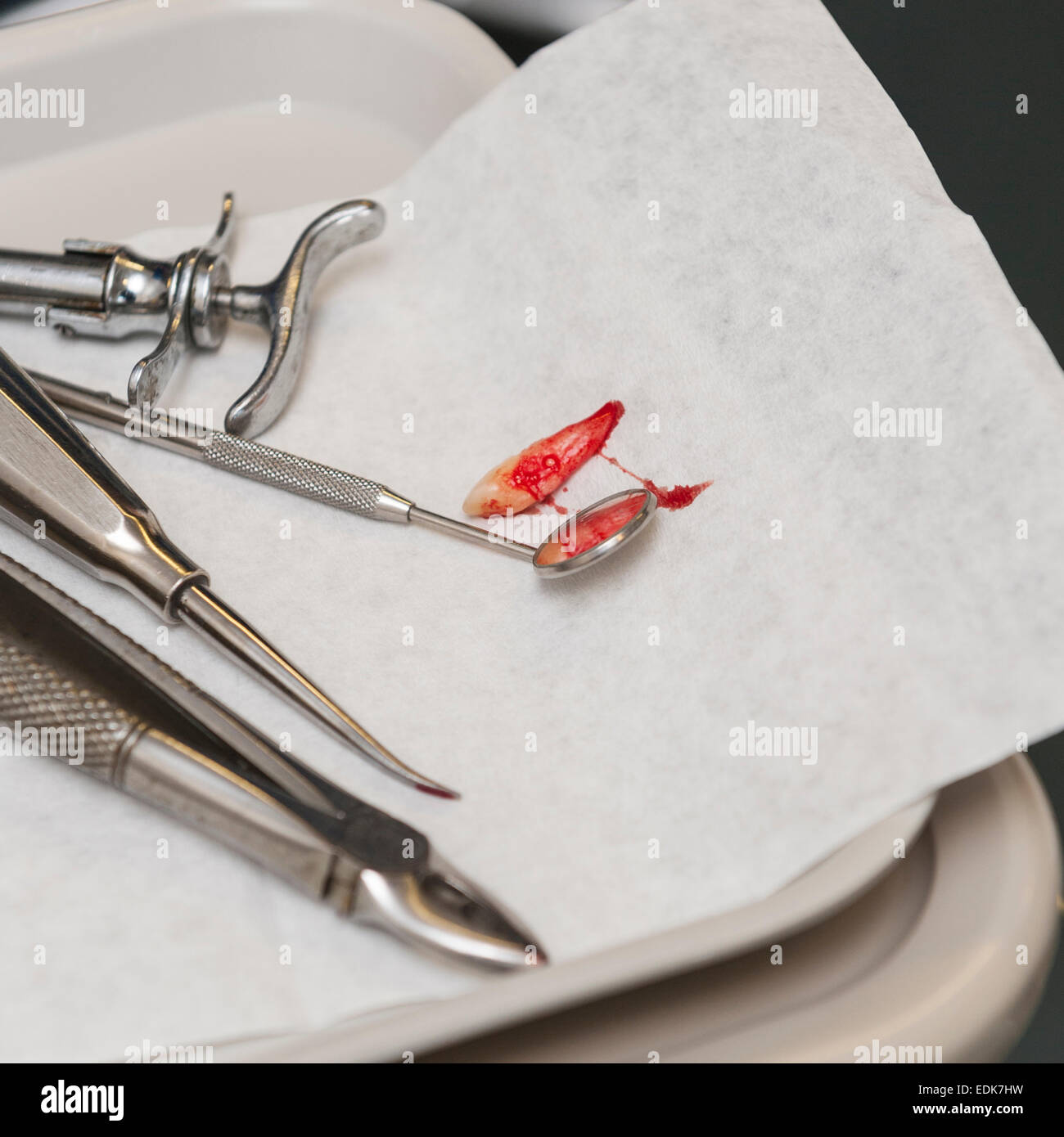 Tooth extraction hi-res stock photography and images - Alamy