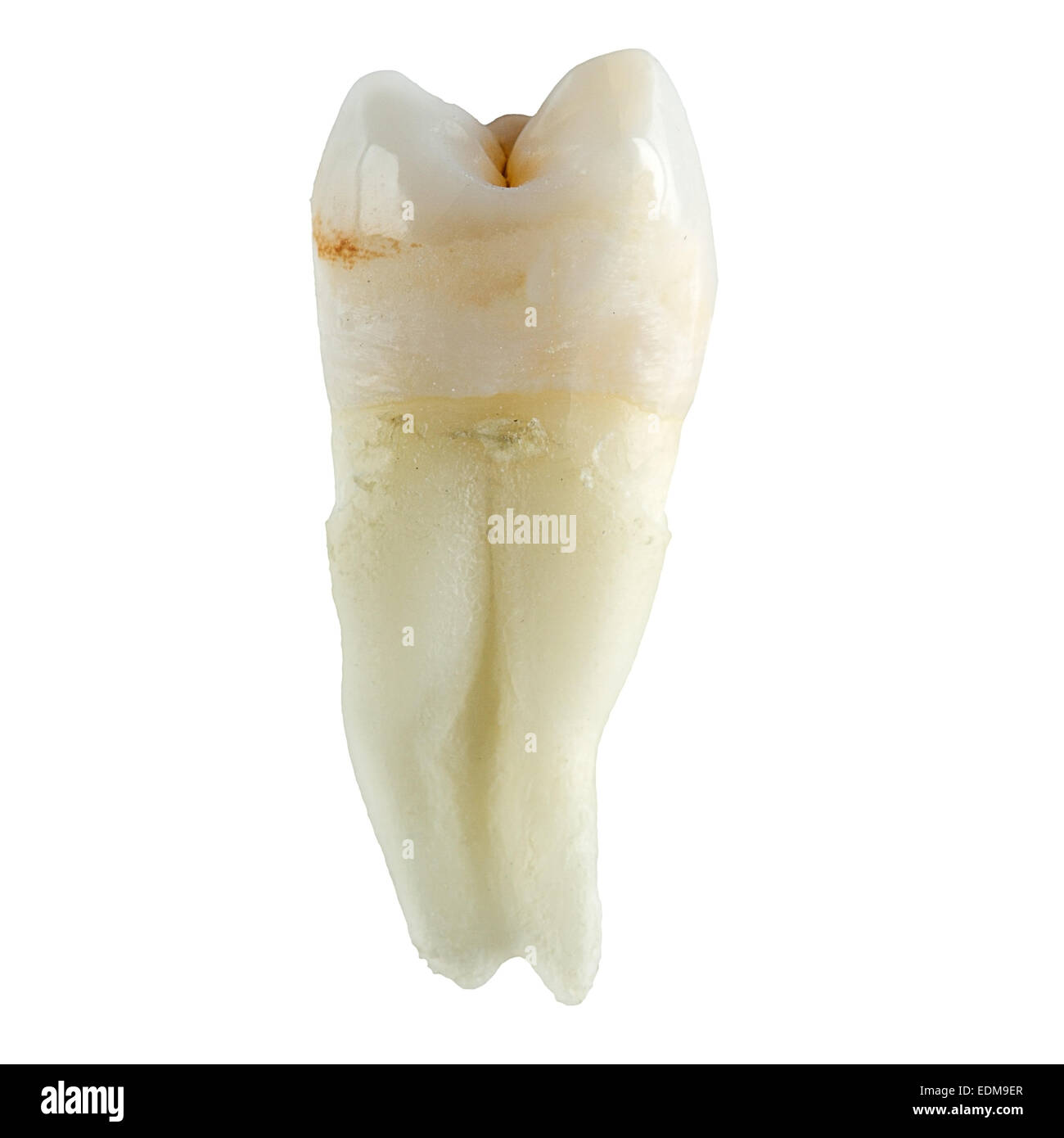 Wisdom Tooth High Resolution Stock Photography and Images - Alamy