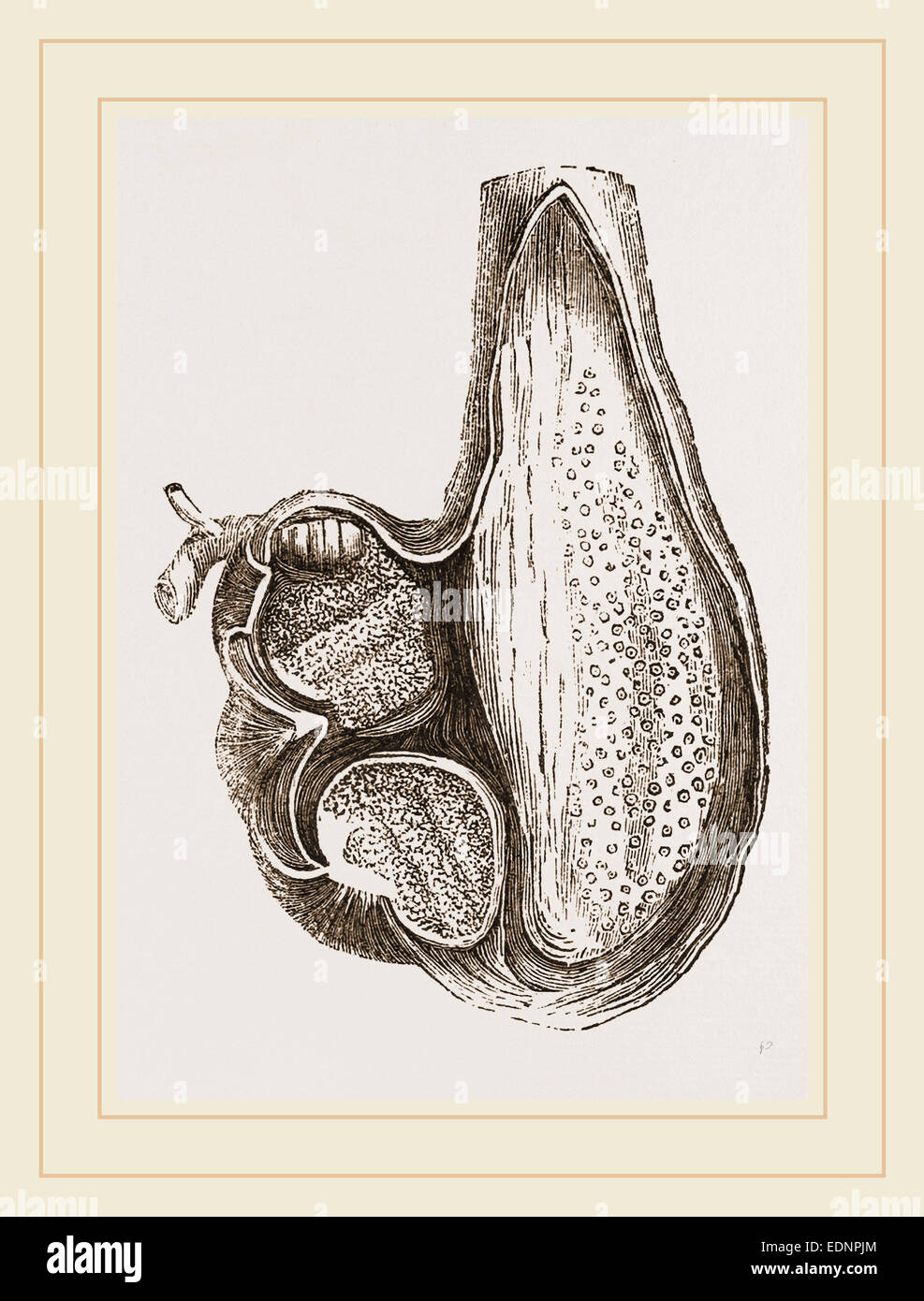 Stomach ostrich hi-res stock photography and images - Alamy